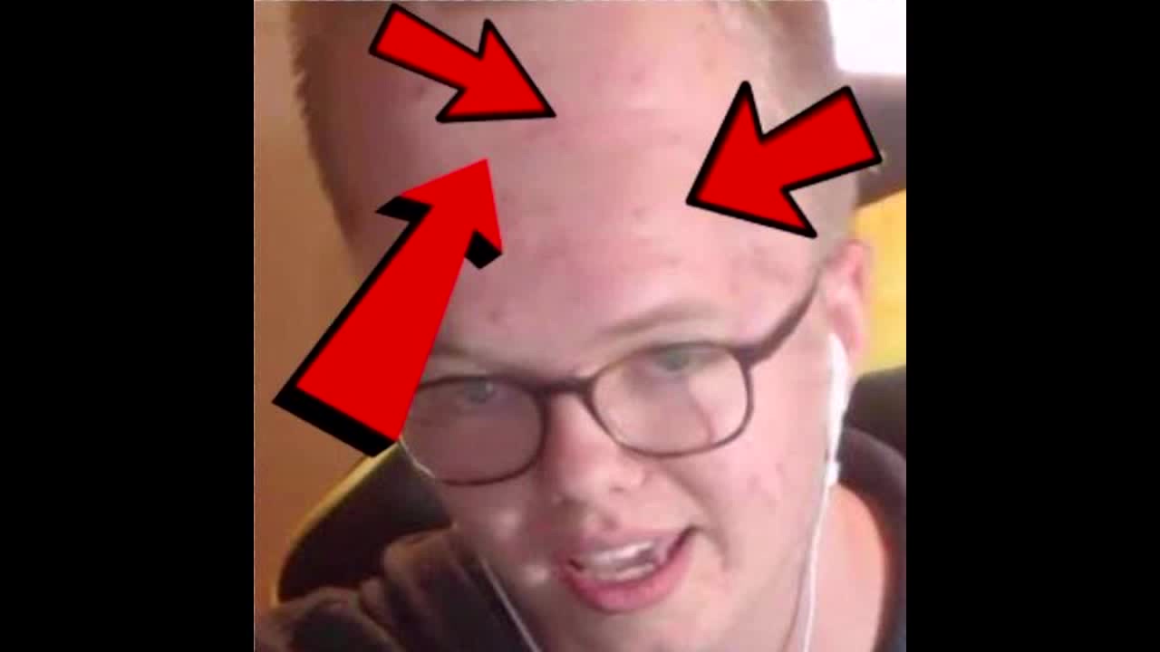 MrTlexify Forehead - Coub