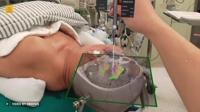 real-time projection of complex 2D imaging, onto the patient's body - Coub