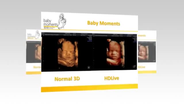 4D Baby scan Berkshire call 08000075076 http://www.scan4d.co.uk/ - Coub