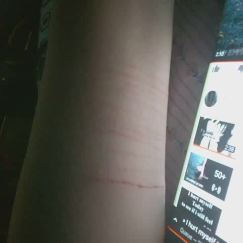 this was why i had it bandaged, i love you baby and miss you i promised i would not do this but ...